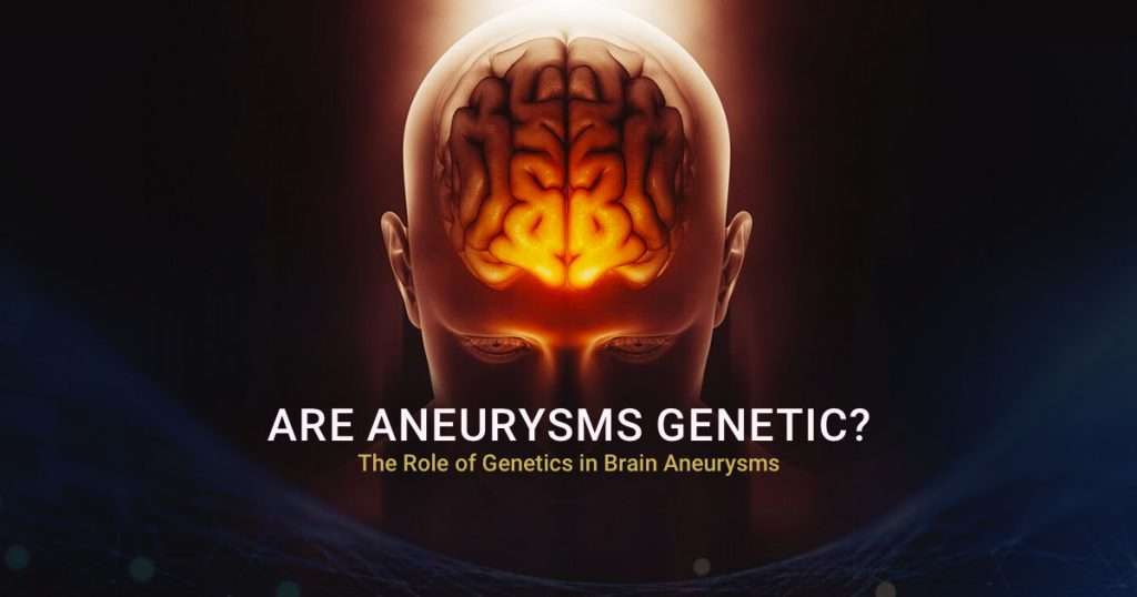 Hereditary Factors in Brain Aneurysms: Is it Genetic?