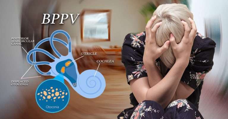 How to Treat Residual Dizziness After Treating BPPV