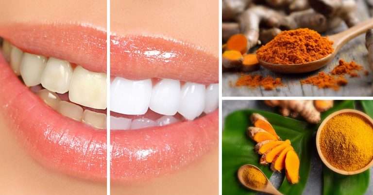 Using Turmeric for Teeth: Benefits and Application Tips