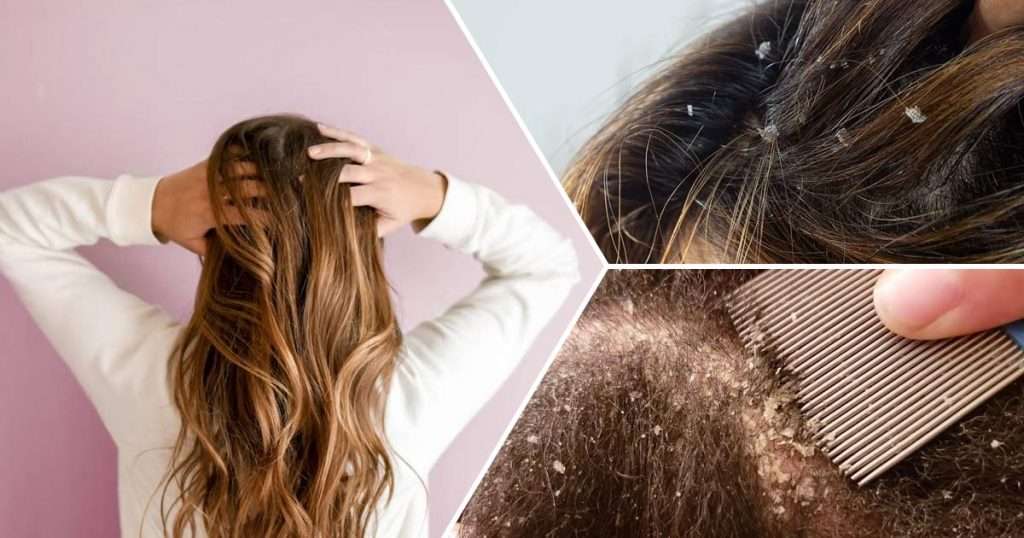 DIY Scalp Exfoliation: 3 Simple Methods and When to Use Them