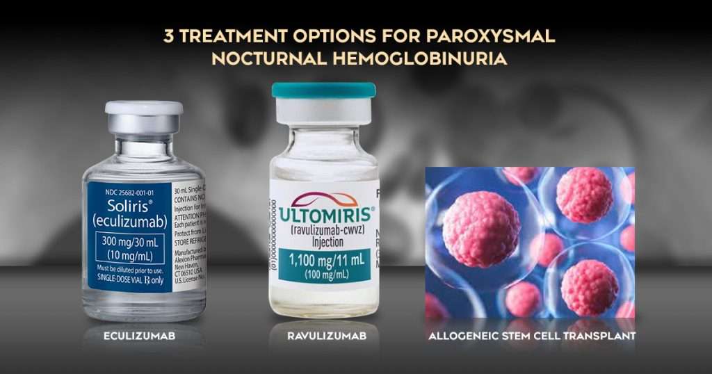 3 Treatment Strategies for Paroxysmal Nocturnal Hemoglobinuria